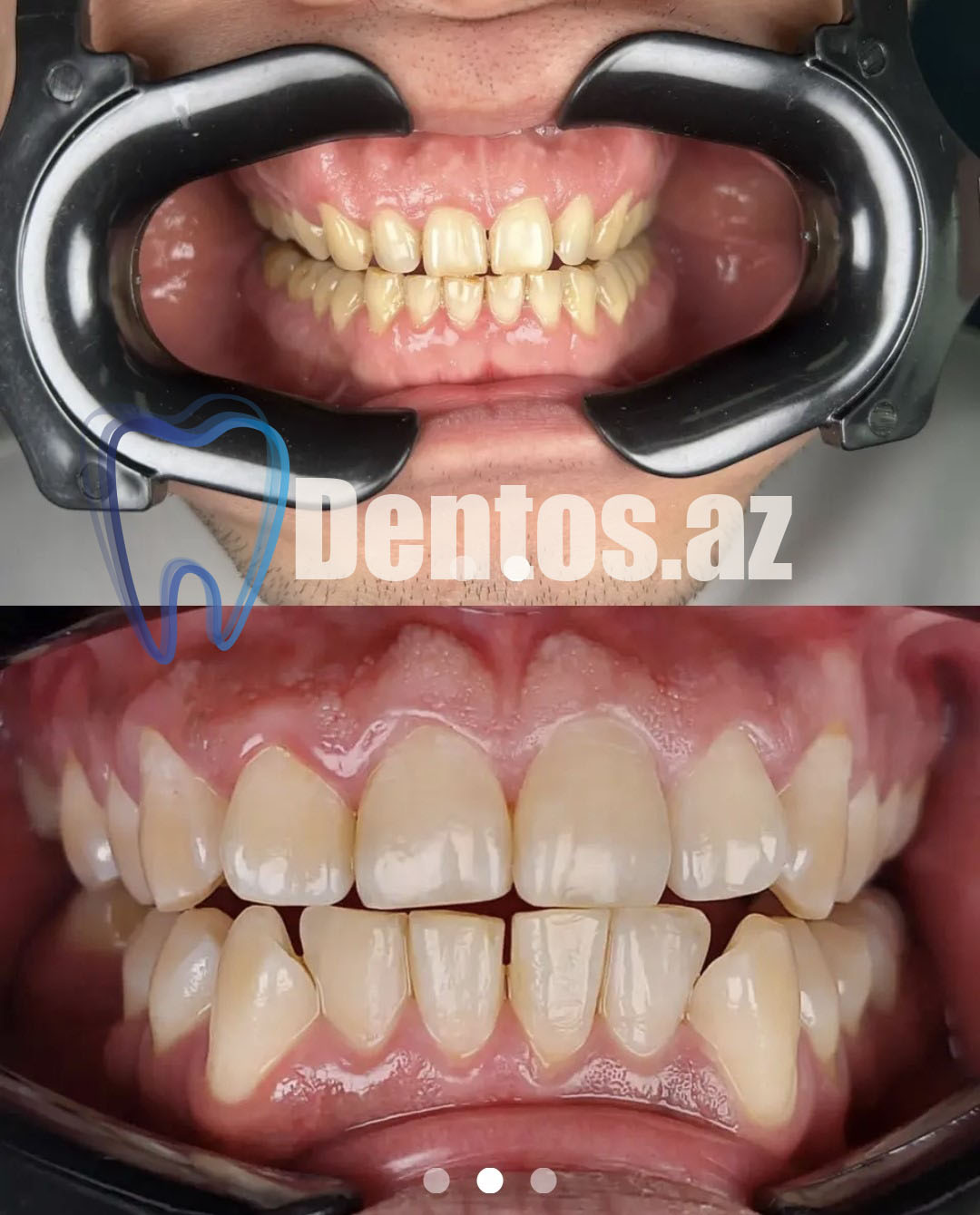 Dental foto kit - Dentos.az